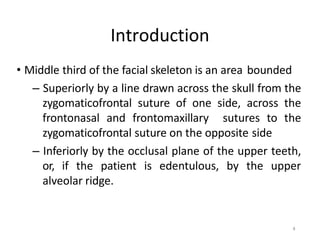 Midfacial fractures | PPTX