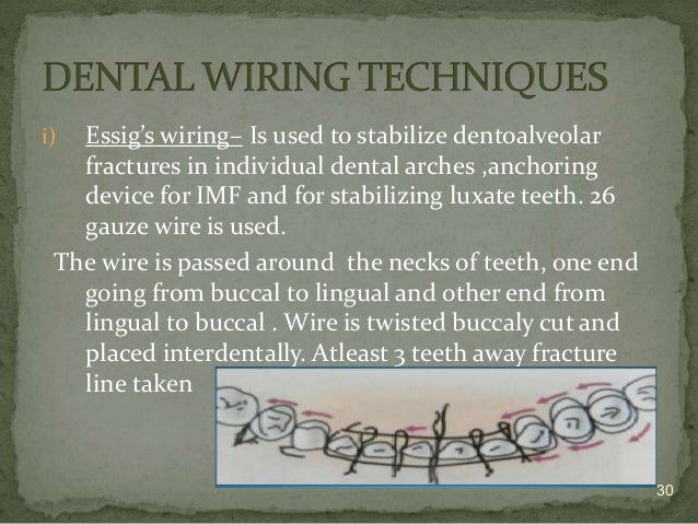 Midfacial fractures - oral surgery b.d.s