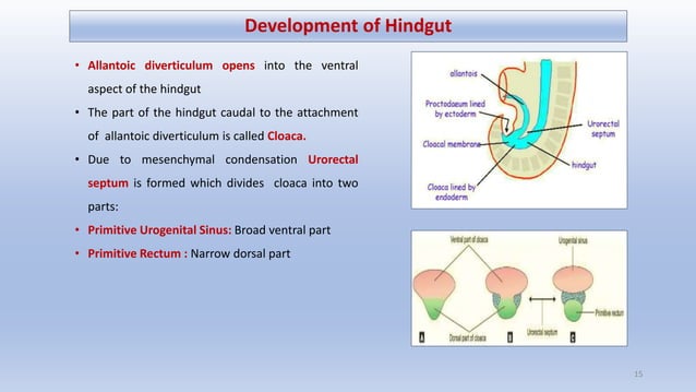 Development of Midgut & Hindgut | PPTX | Digestive Disorders | Diseases ...