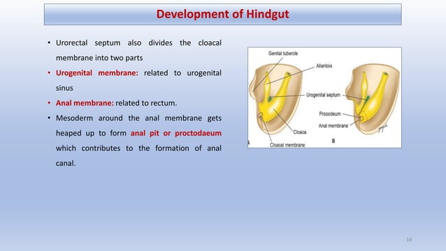 Development of Midgut & Hindgut | PPTX | Digestive Disorders | Diseases ...