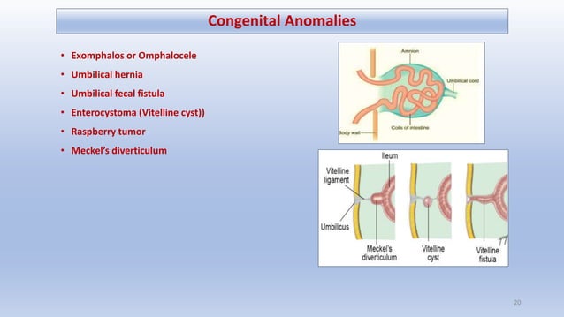 Development of Midgut & Hindgut | PPTX | Digestive Disorders | Diseases ...