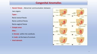 Development of Midgut & Hindgut | PPTX
