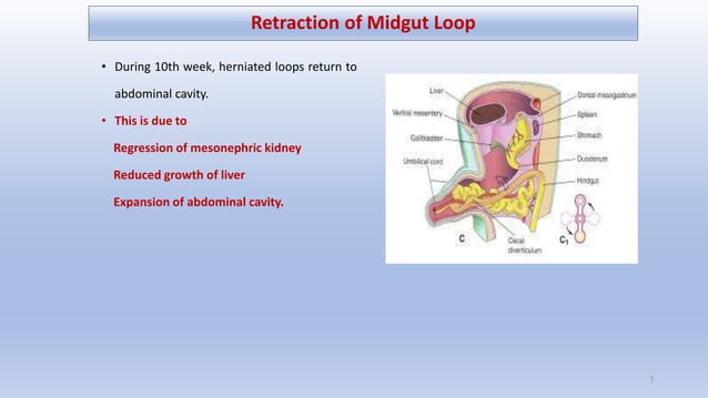 Development of Midgut & Hindgut | PPTX | Digestive Disorders | Diseases ...