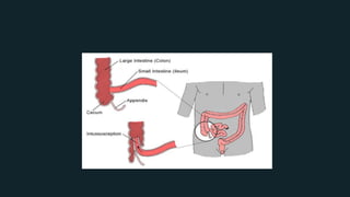 Midgut | PPT