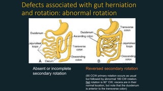 Midgut | PPT