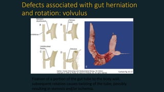 Midgut | PPT