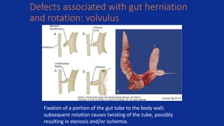 Midgut | PPTX