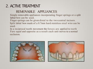 midline diastema-1.pptx