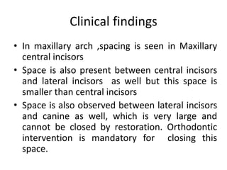 Midline diastema dr arsalan | PPT