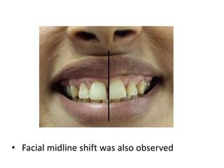 Midline diastema dr arsalan | PPT