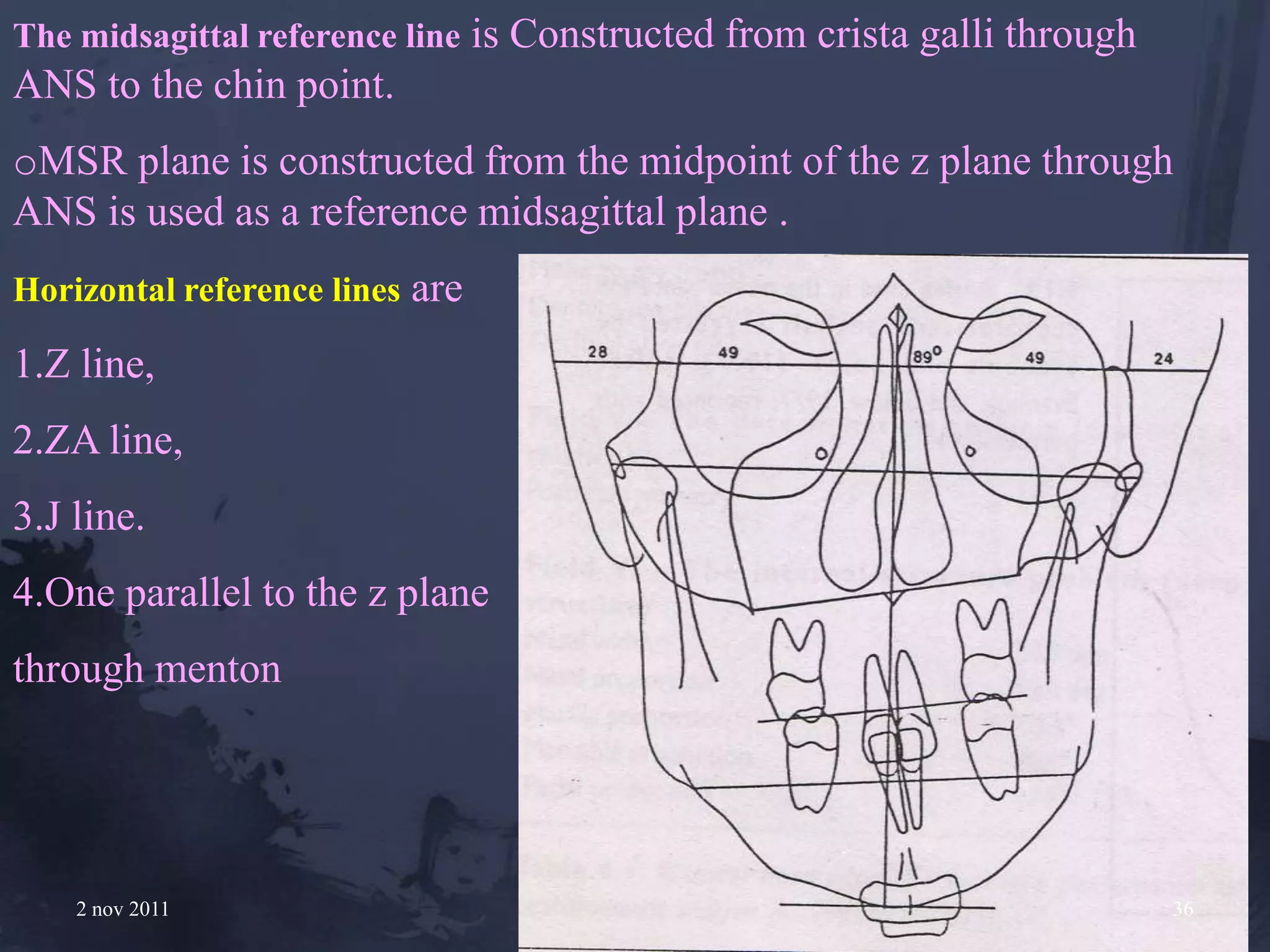 Midline discrepancies | PPTX