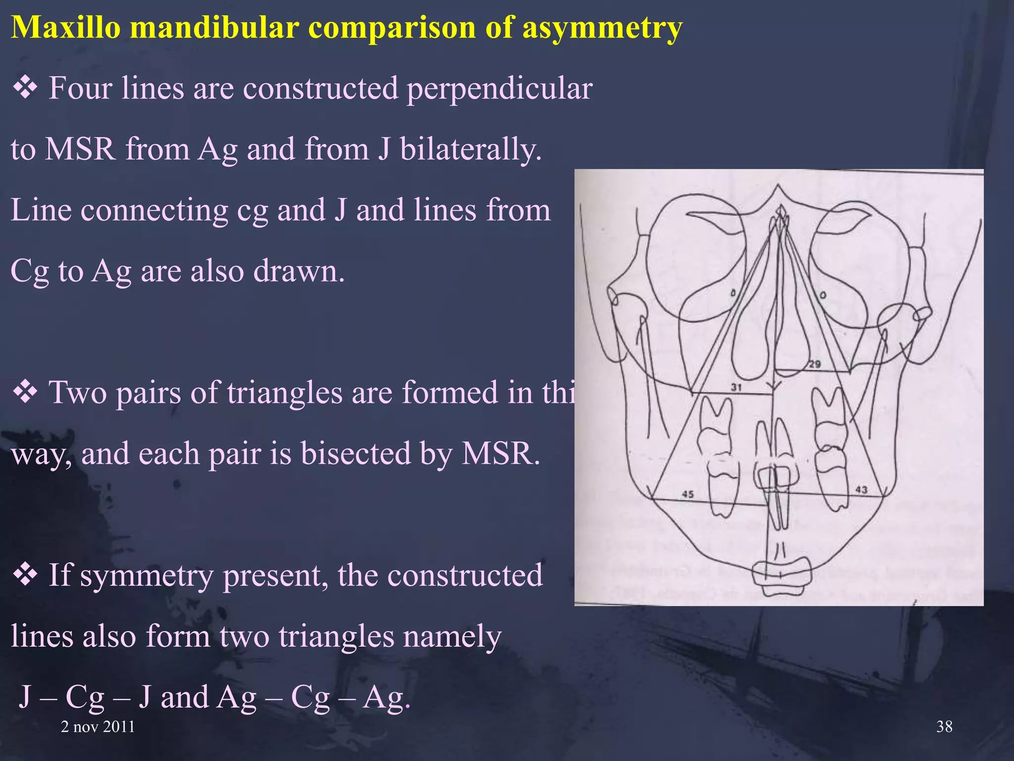 Midline discrepancies | PPTX