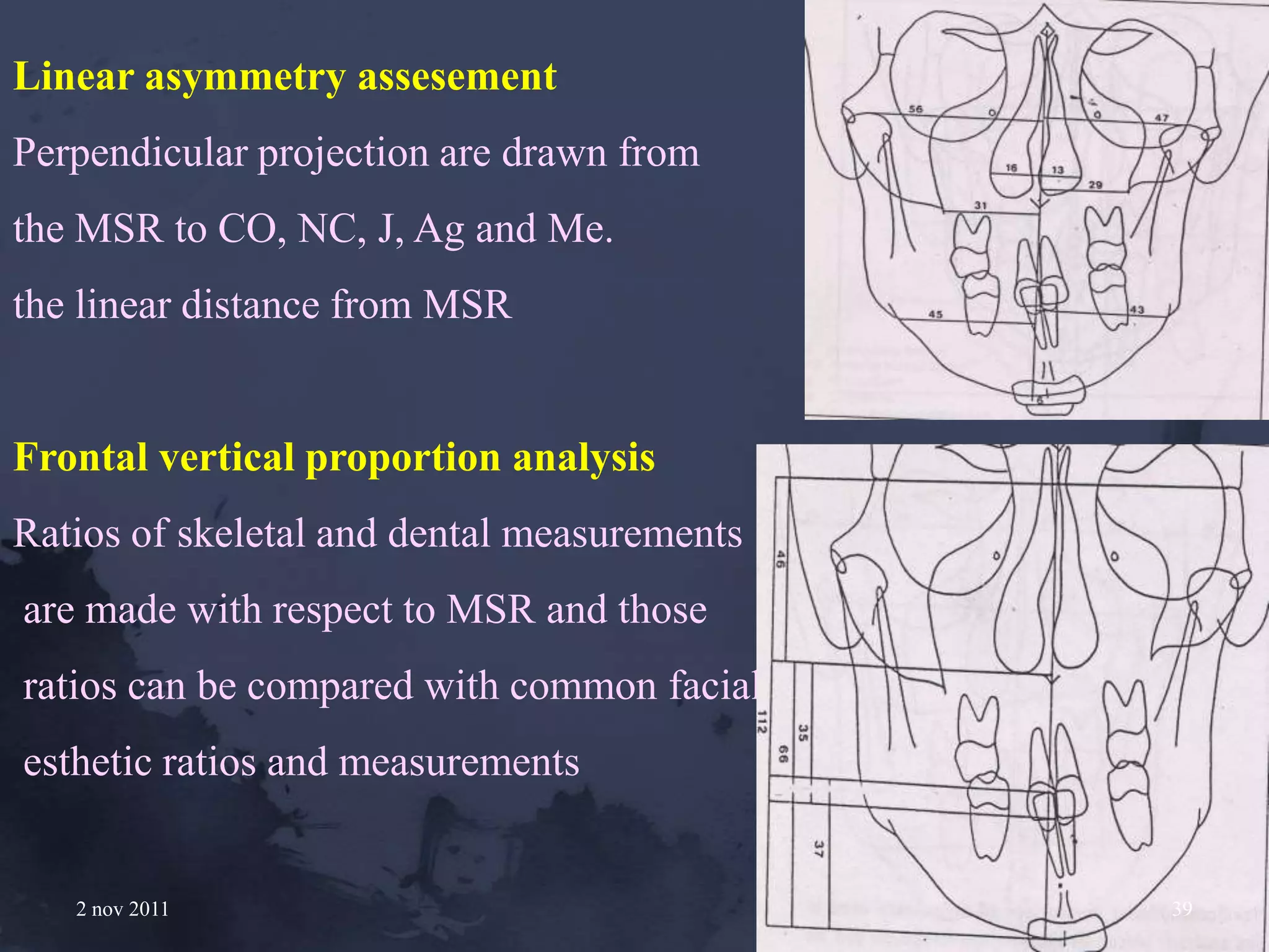 Midline discrepancies | PPTX