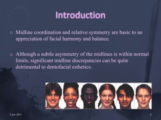 Midline discrepancies | PPTX