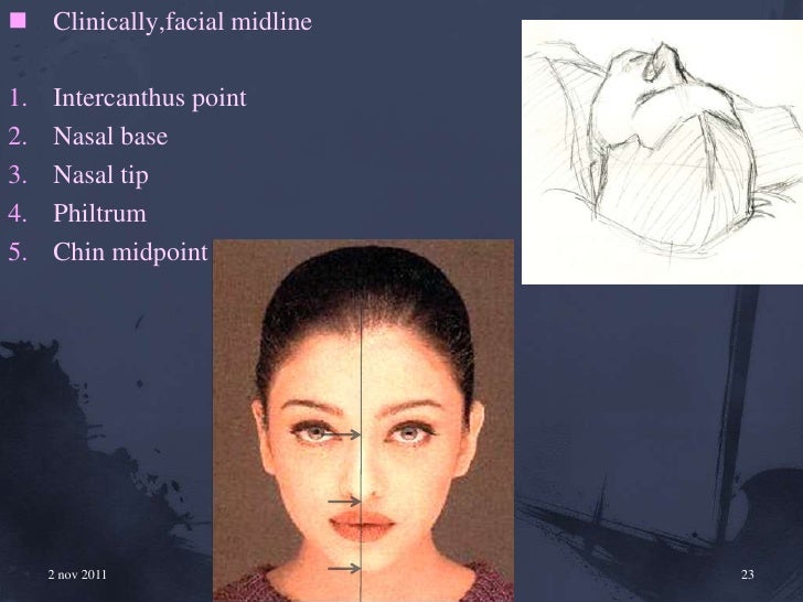 Midline discrepancies