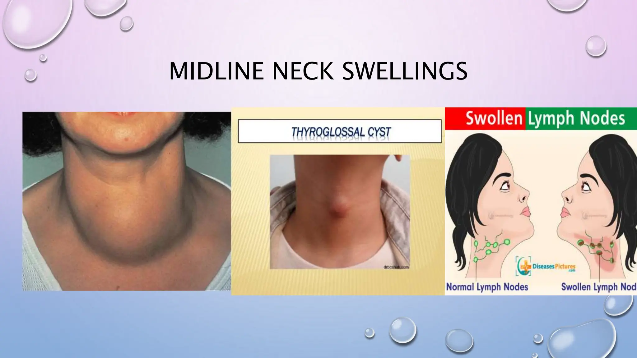 MIDLINE STRUCTURES OF NECK anatomy PowerPoint | PPTX