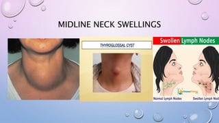 MIDLINE STRUCTURES OF NECK anatomy PowerPoint | PPTX