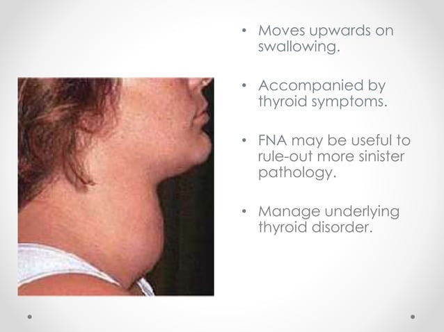 Midline swellings of the neck | PPTX