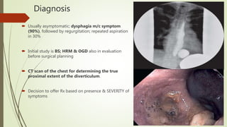 mid & lower esophageal diverticulum.pptx