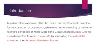 Midpalatal suture maturation in orthodontics.pptx