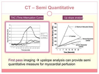 Myocardial Infraction diagnosis using CT-Scan & MRI | PPT