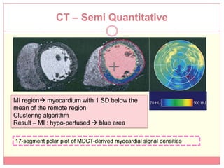 Myocardial Infraction diagnosis using CT-Scan & MRI | PPT