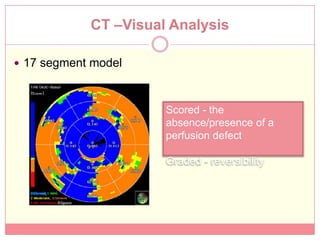 Myocardial Infraction diagnosis using CT-Scan & MRI | PPT