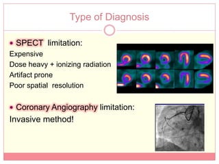 Myocardial Infraction diagnosis using CT-Scan & MRI | PPT