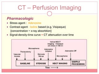 Myocardial Infraction diagnosis using CT-Scan & MRI | PPT