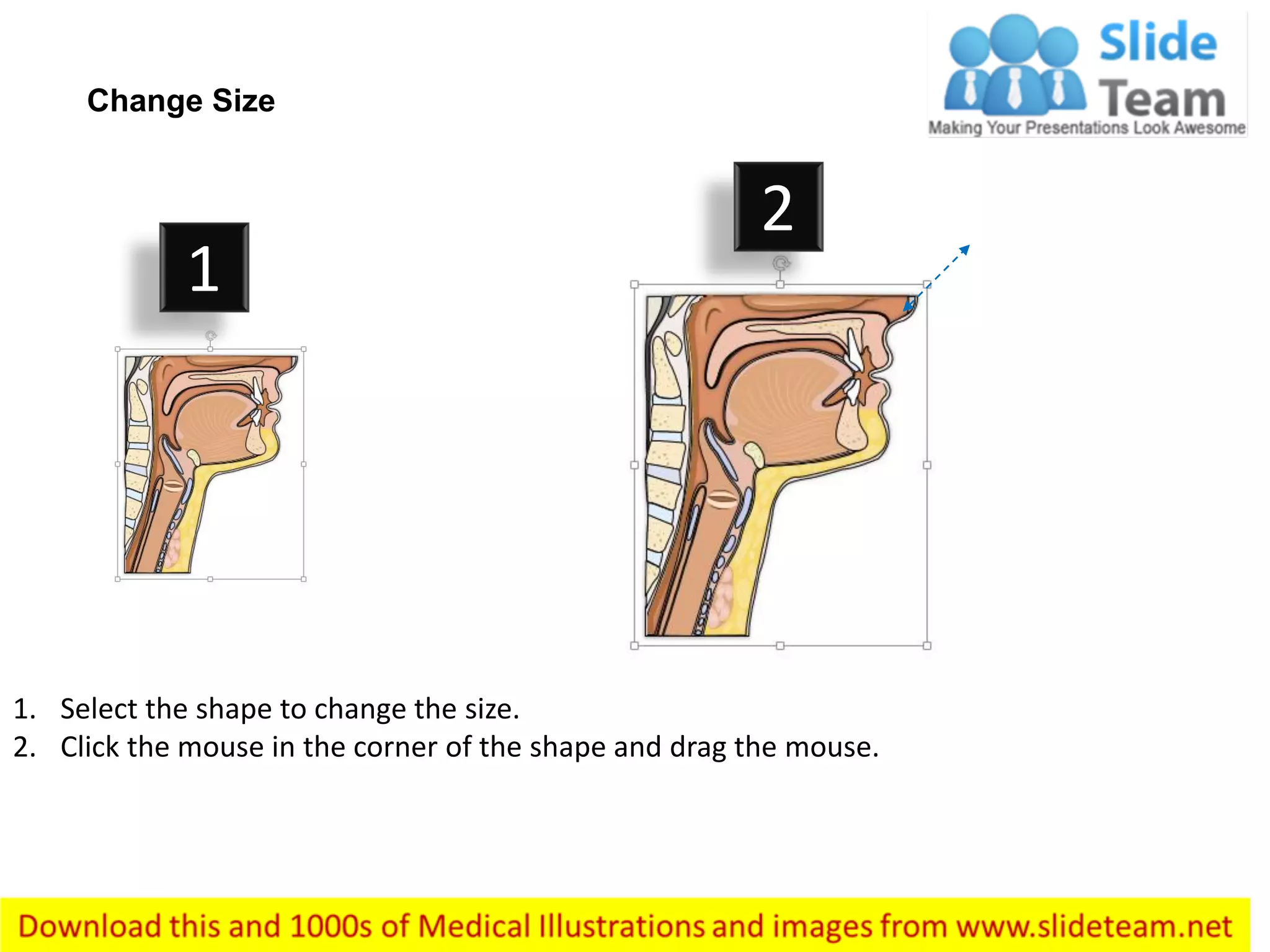 Mid sagital and laryngoscopic view of larynx medical images for power ...