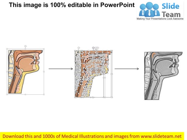 Mid sagital and laryngoscopic view of larynx medical images for power ...