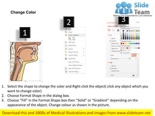 Mid Sagittal View Of Larynx