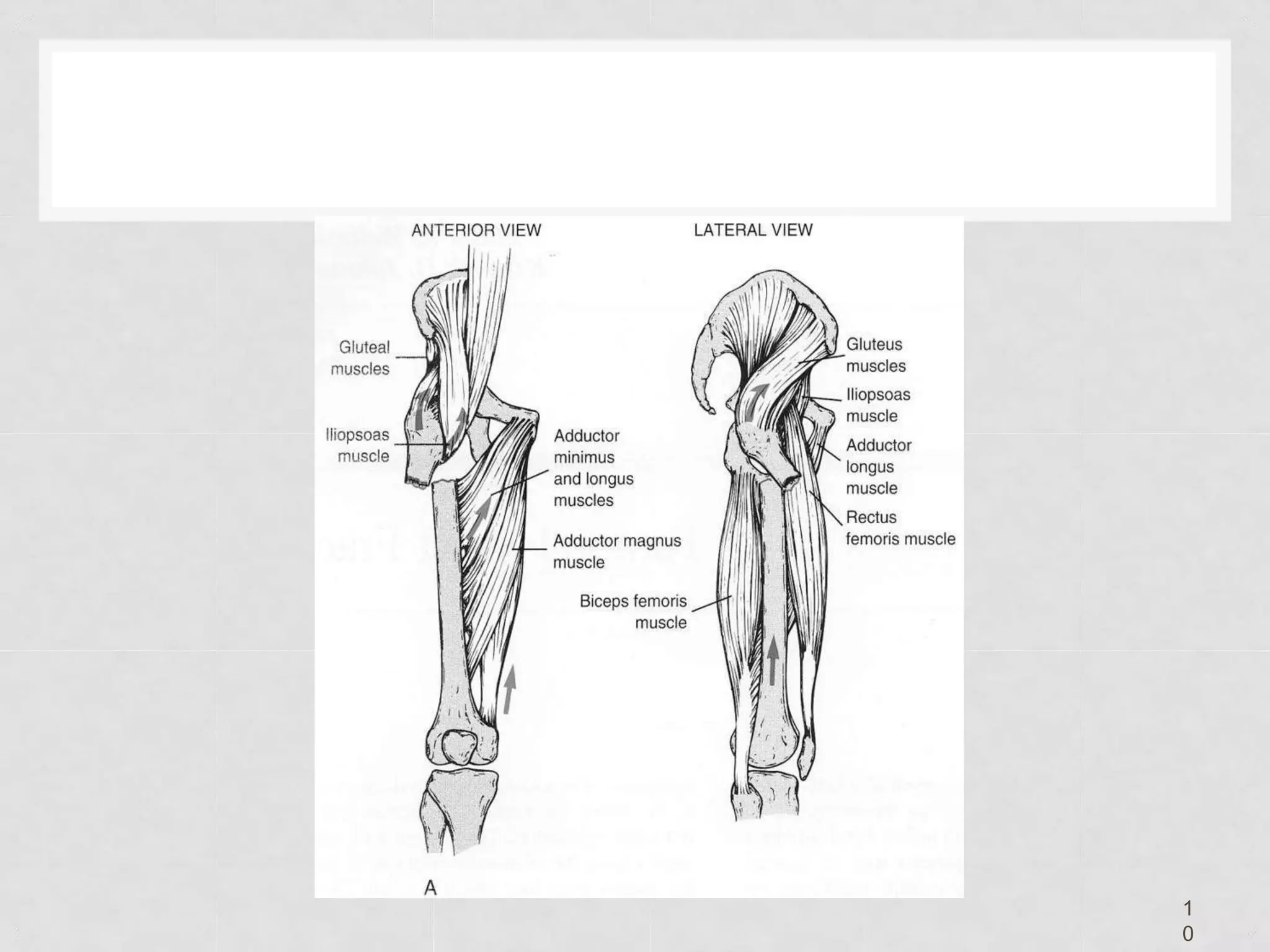 Midshaft femur fracture | PPTX