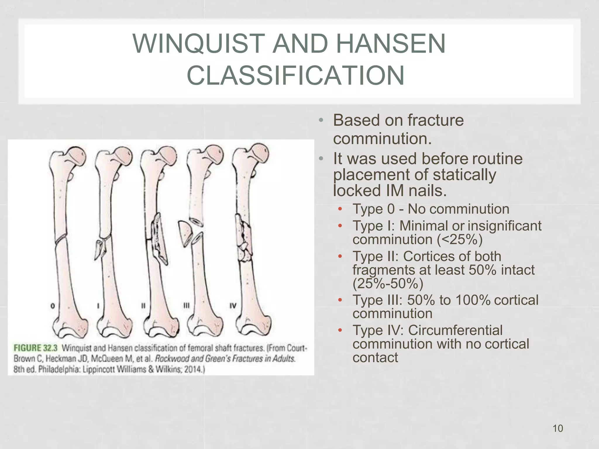 Midshaft femur fracture | PPTX