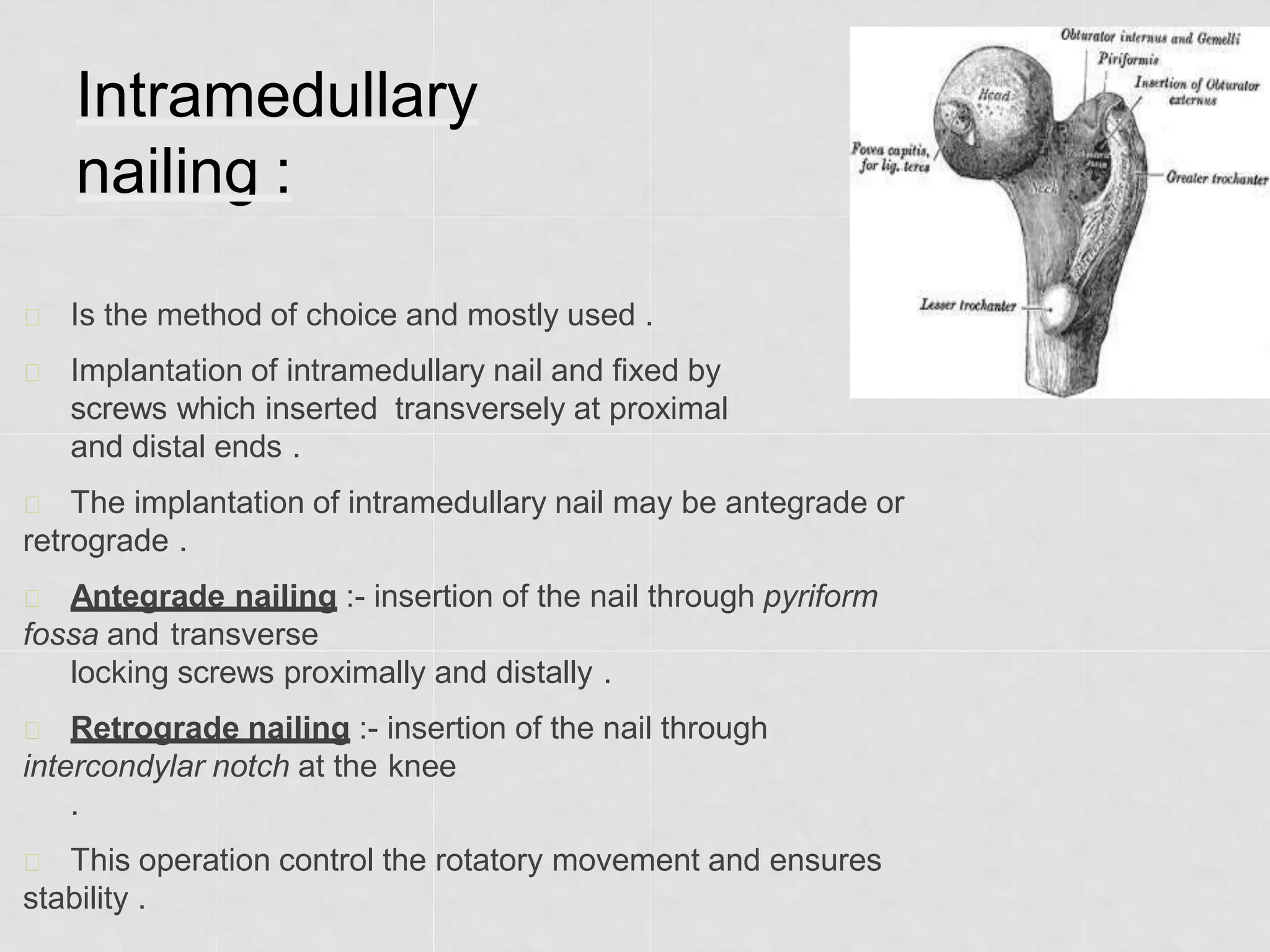 Midshaft femur fracture | PPTX