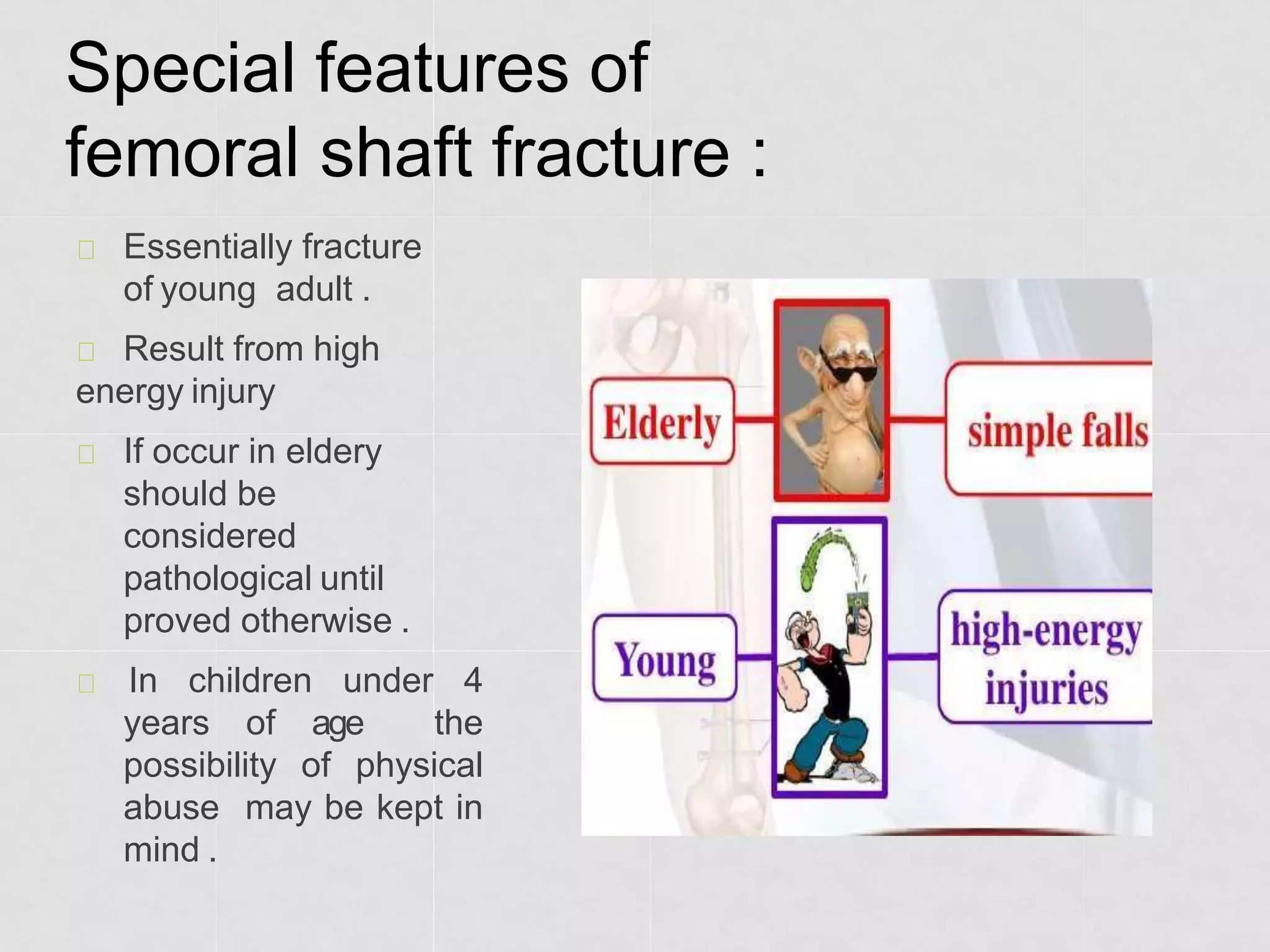 Midshaft femur fracture | PPTX