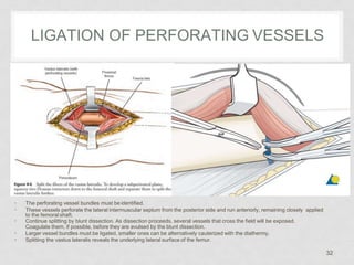 Midshaft femur fracture | PPTX