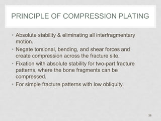 Midshaft femur fracture | PPTX