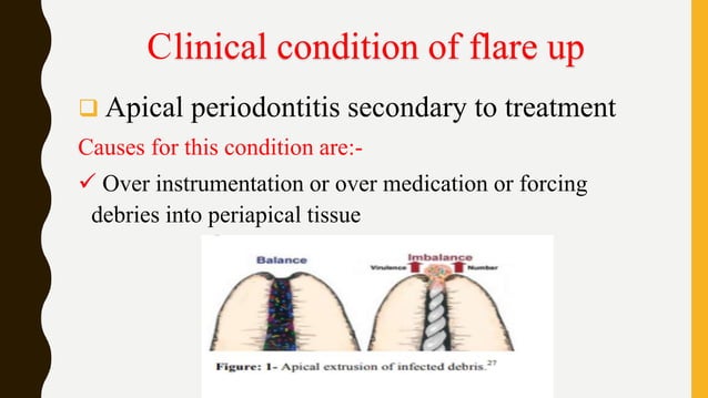 Mid treatment flare ups in endodontic | PPTX | Dental Health | Diseases ...