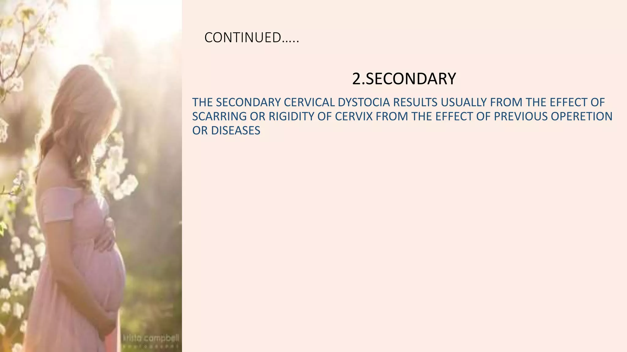 Midwifery cervical dystocia | PDF