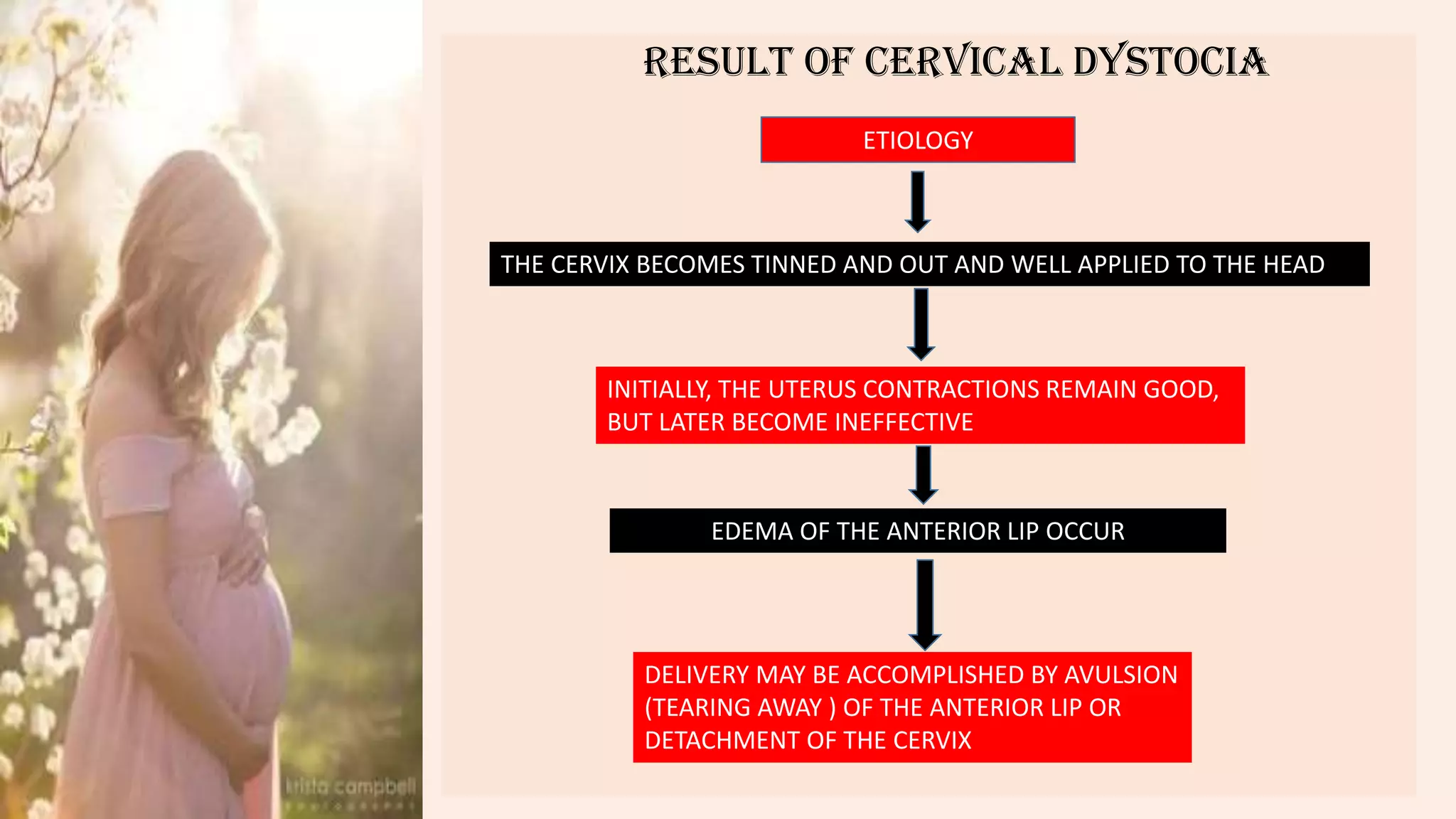 Midwifery cervical dystocia | PDF