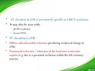 Subendocardial Infarction Ecg