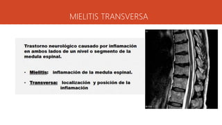 Mielitis transversa | PPTX