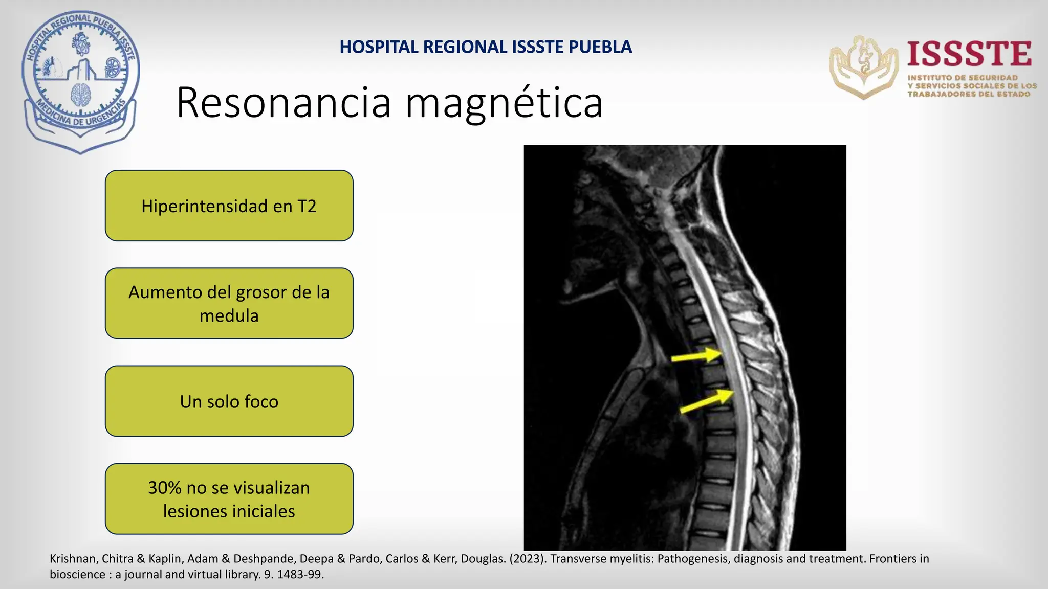 Mielitis transversa diagnóstico tratamiento | PPT