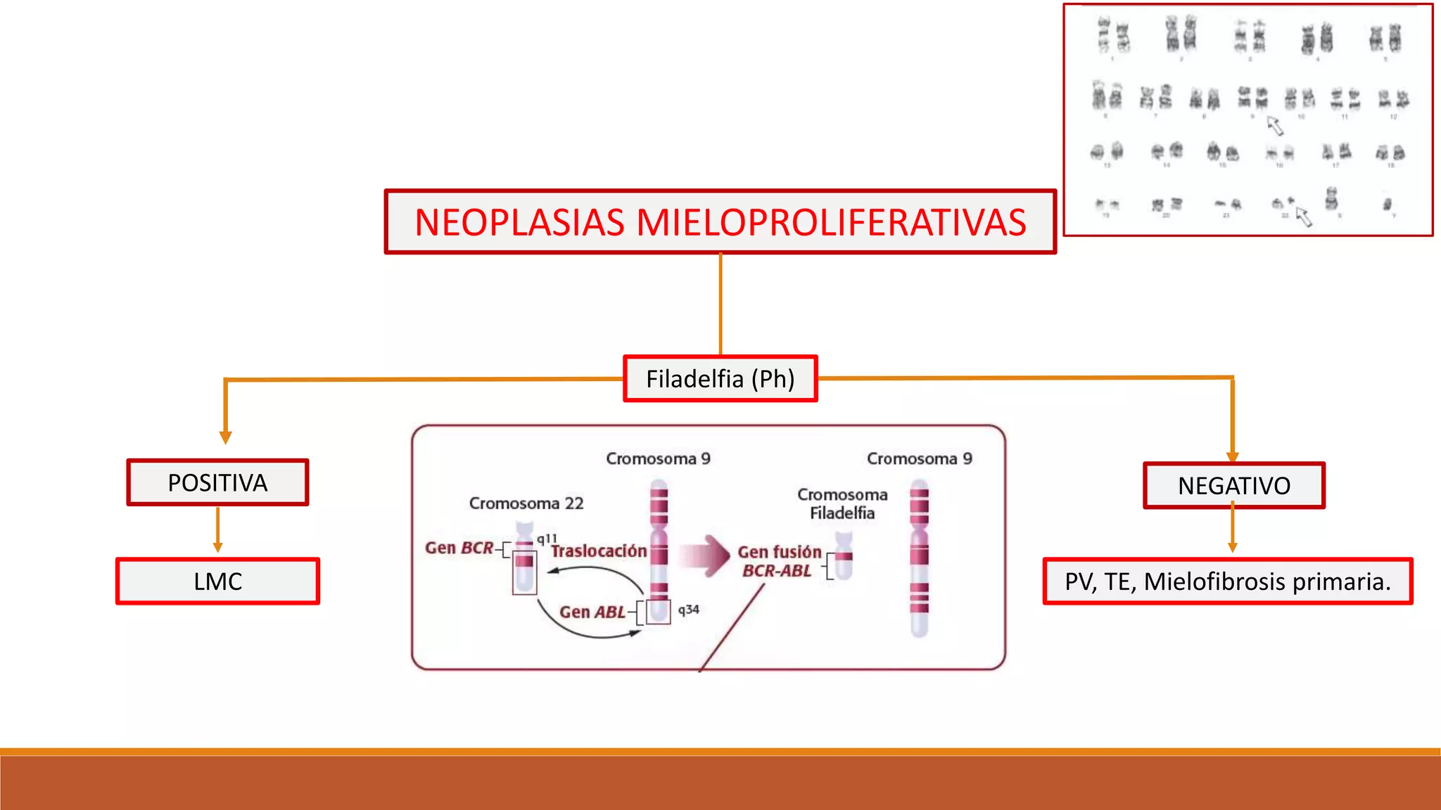 Mielofibrosis Primaria | PPTX