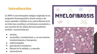 Mielofibrosis primaria Hematología y medicina | PDF