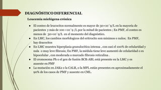 SINDROMES MIELO. MIELOFIBROSIS PRIMARIA 30.6.24.pptx