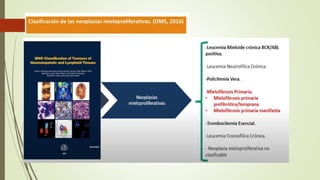 SINDROMES MIELO. MIELOFIBROSIS PRIMARIA 30.6.24.pptx