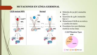 SINDROMES MIELO. MIELOFIBROSIS PRIMARIA 30.6.24.pptx
