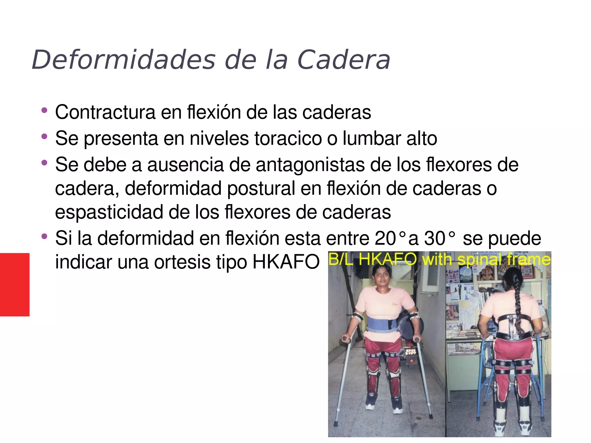 Disrafias espinales, tratamiento quirurgico de deformidades especificas ...